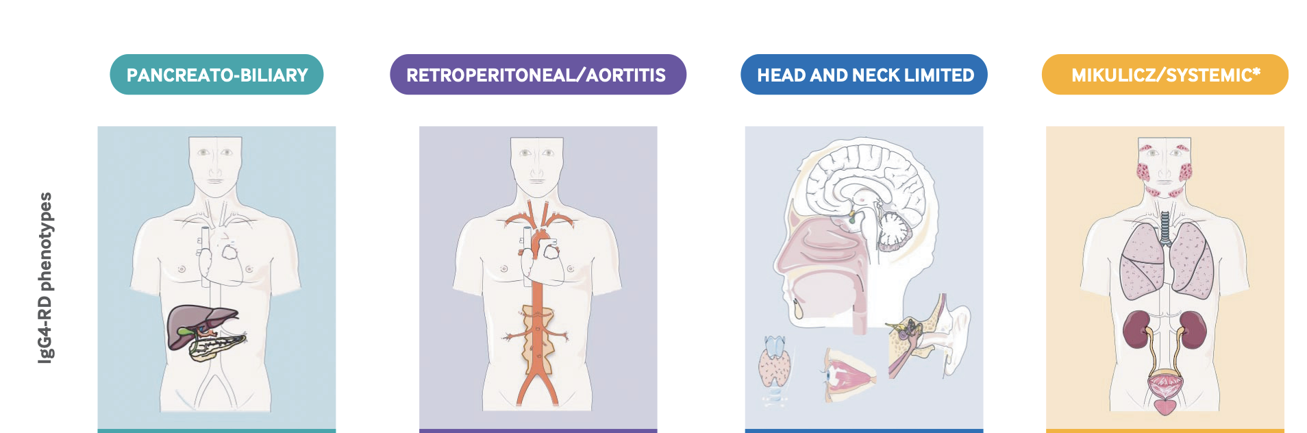 Disease IgG4 - ERN ReCONNET | European Reference Network on Rare and ...